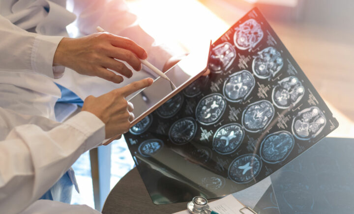 NeuroVasc Technologies • Neurovascular Device Design and Development